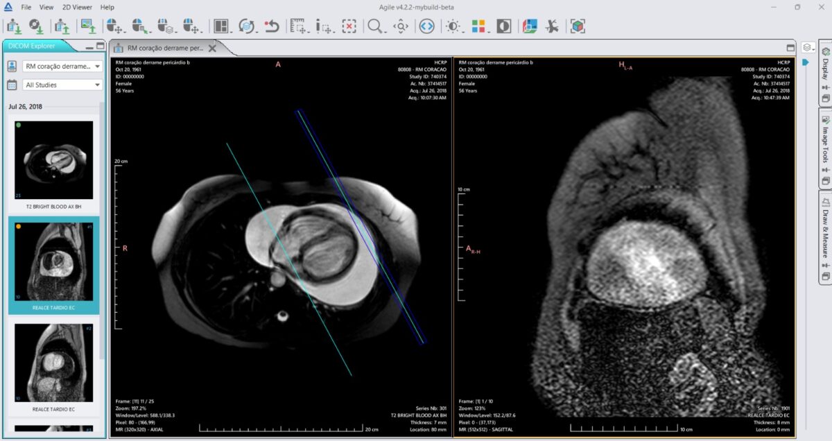 Agile Viewer - Agile Suite